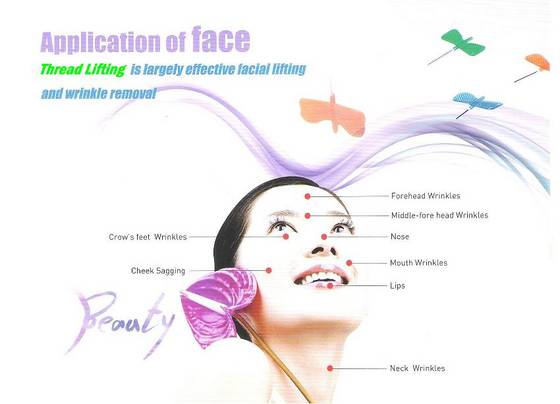 Polydioxanone Suture Thread Lifting - Dongwoo M Techno Co., Ltd.